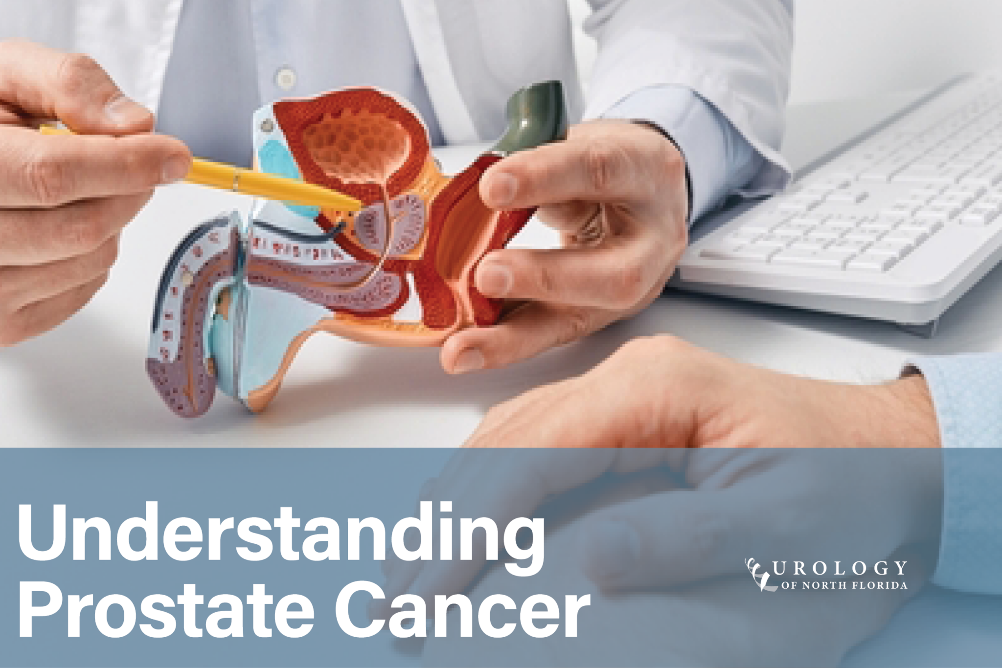 Shedding Light on Prostate Cancer - Urology of North Florida